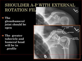 External Rotation Shoulder Xray