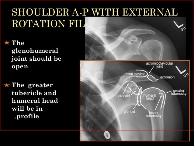 Shoulder joint xray & usg by Dr Soumitra Halder