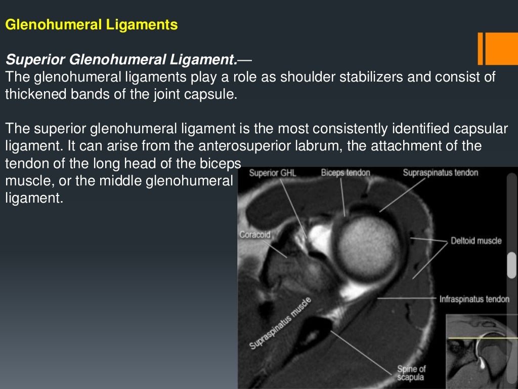 Shoulder labral tears MRI