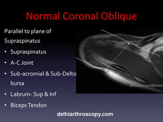 Shoulder Mri Scan in Delhi by Dr Shekhar Shrivastav | PDF