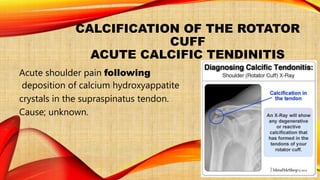 Shoulder orthopedic disorders (dr.farouk) | PPTX