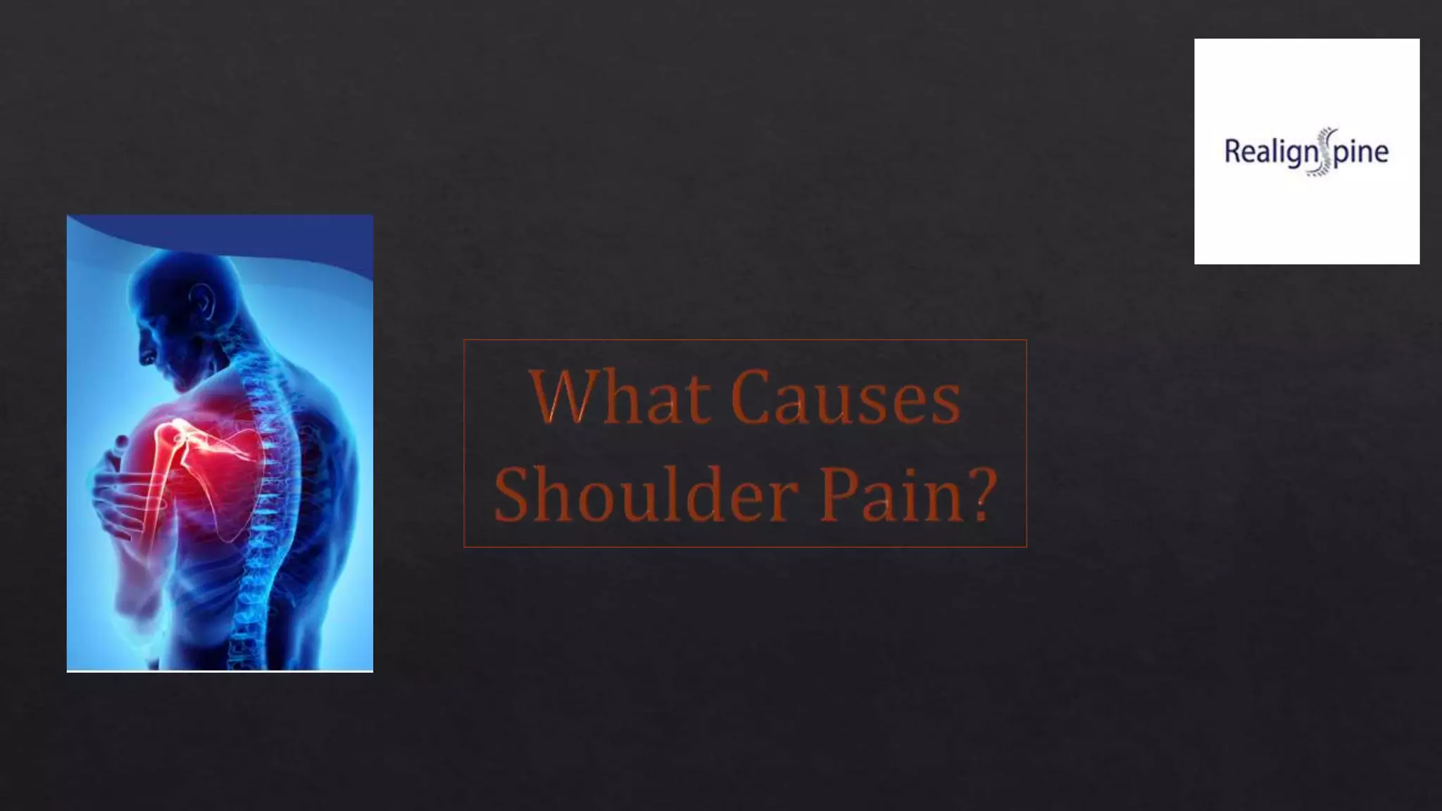Shoulder Pain Causes | PPTX