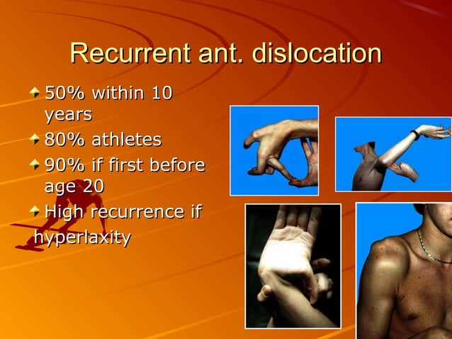Shoulder Pain Diagnosis by Dr Cherif Tadros | PPT | Death, Injury, or ...