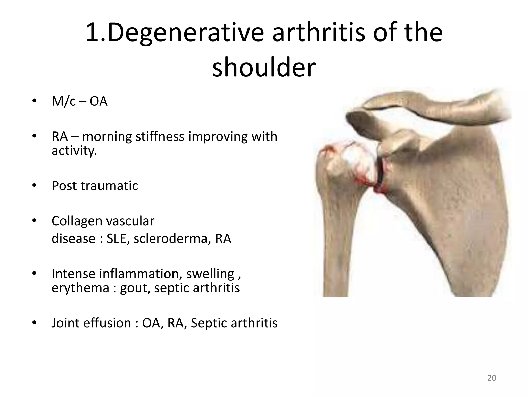 SHOULDER PAIN Diff. Diagnosis RB.pptx