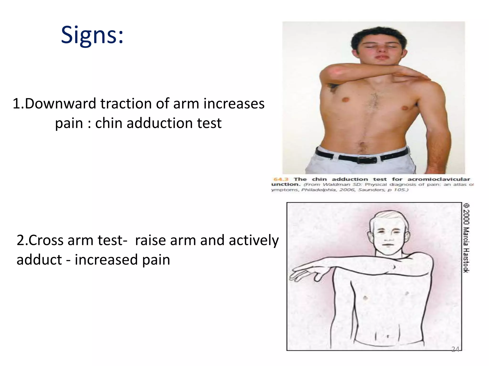 SHOULDER PAIN Diff. Diagnosis RB.pptx