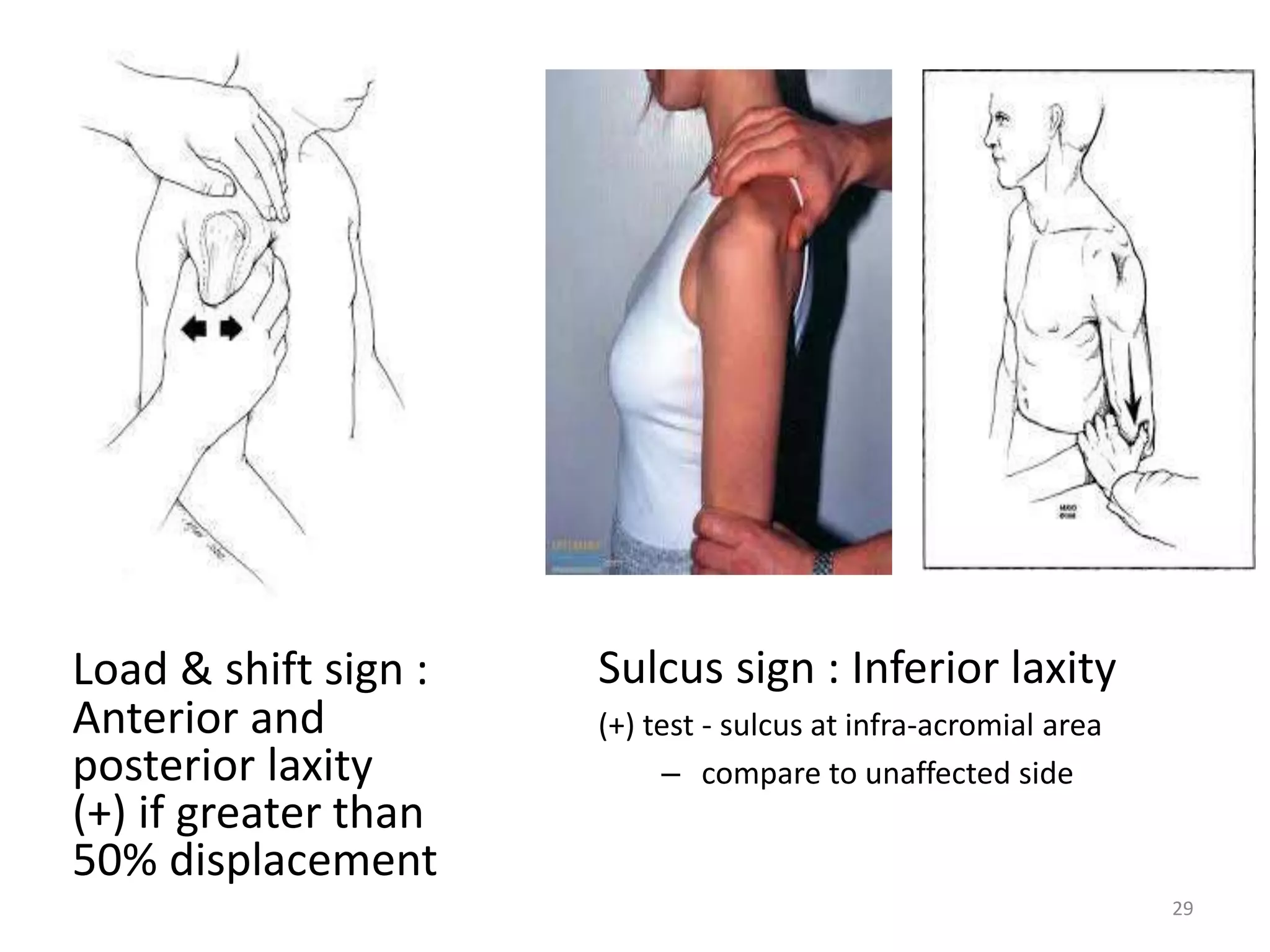 SHOULDER PAIN Diff. Diagnosis RB.pptx