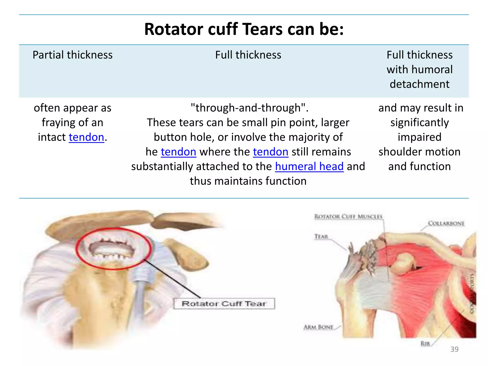 SHOULDER PAIN Diff. Diagnosis RB.pptx