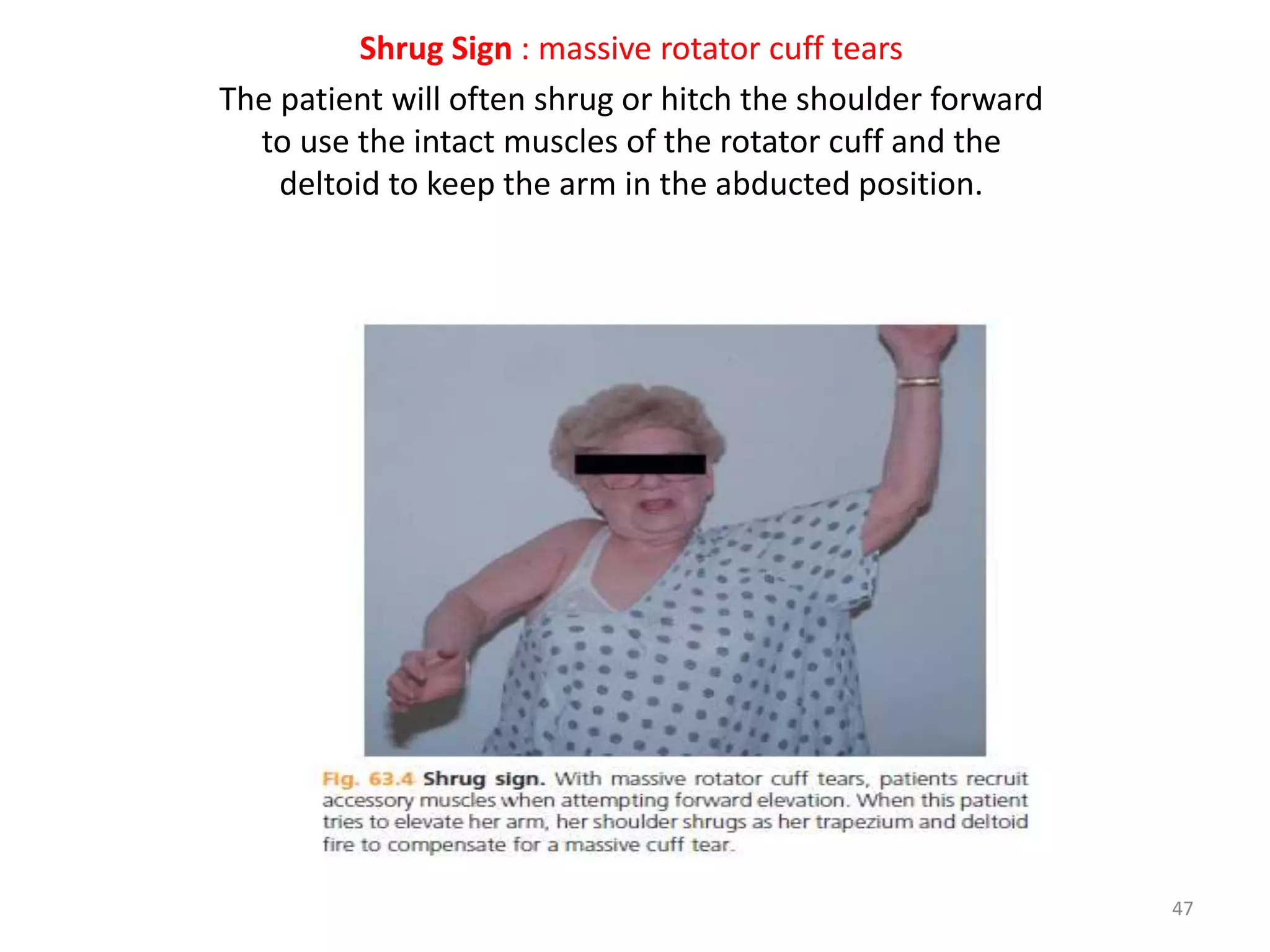 SHOULDER PAIN Diff. Diagnosis RB.pptx