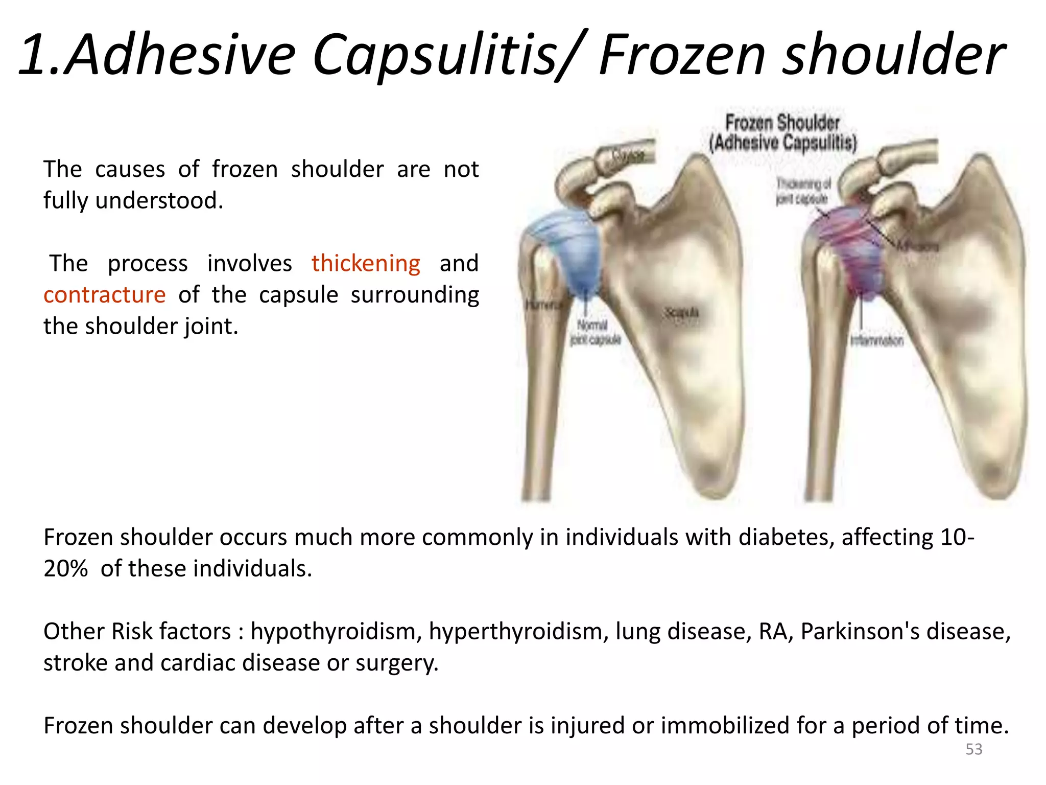 SHOULDER PAIN Diff. Diagnosis RB.pptx