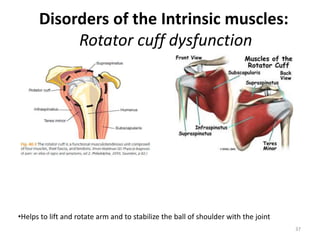 SHOULDER PAIN Diff. Diagnosis RB.pptx