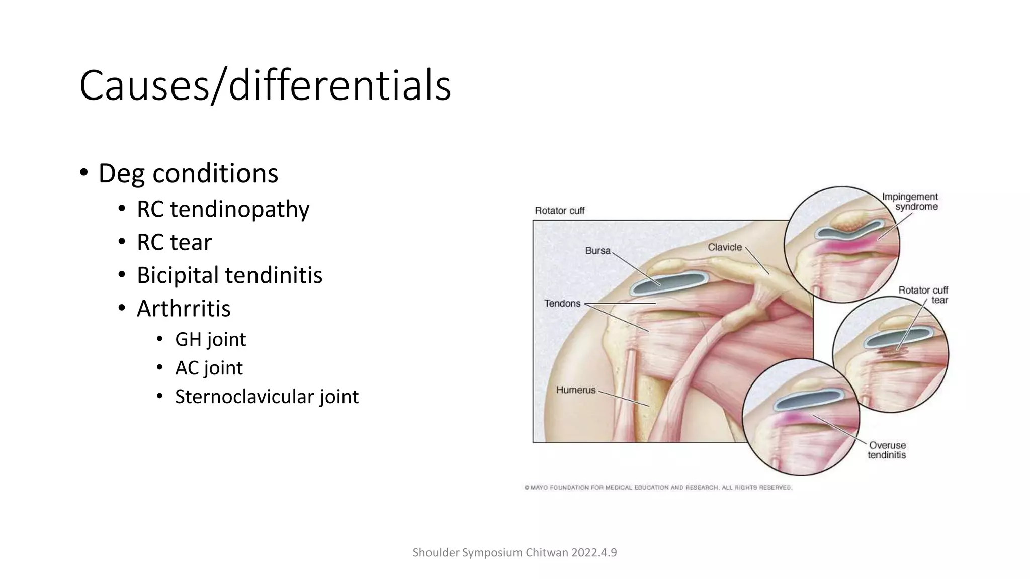 Shoulder pain n delayed diagnosis.pptx