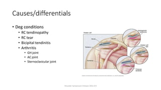 Shoulder pain n delayed diagnosis.pptx