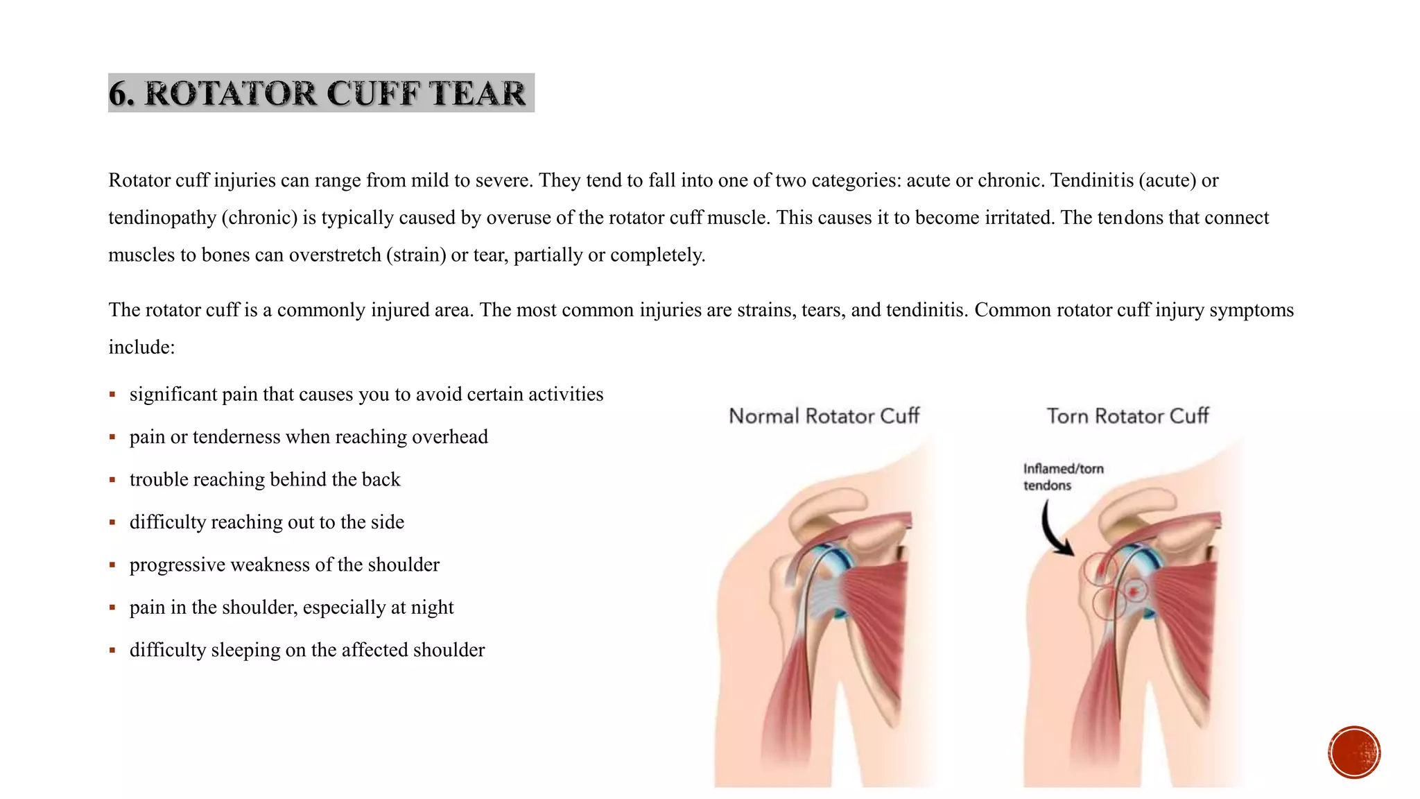 shoulder patho.pptx
