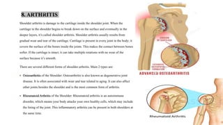 shoulder patho.pptx