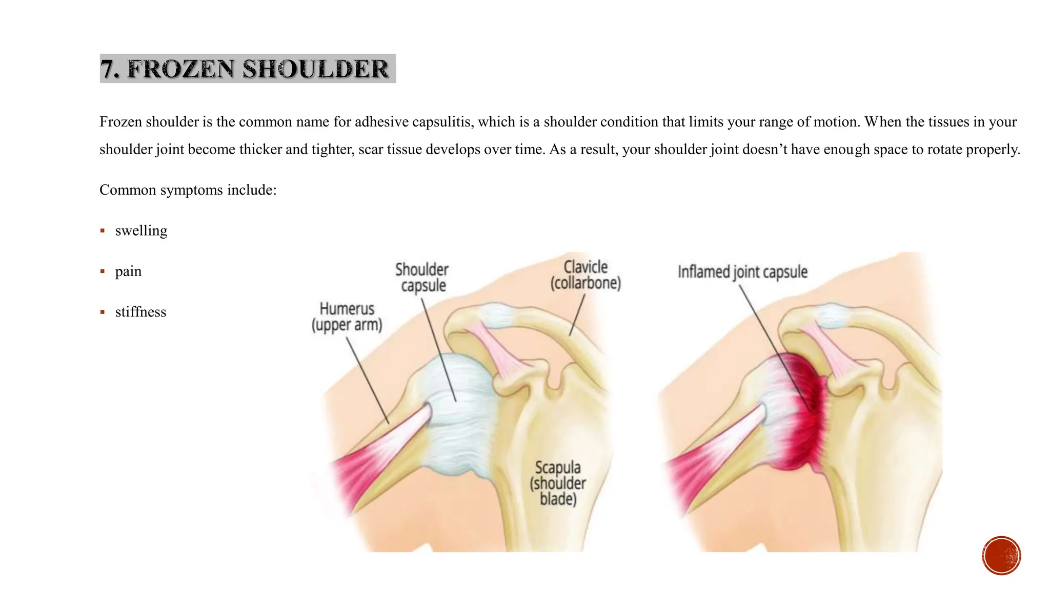 SHOULDER PATHO.pptx