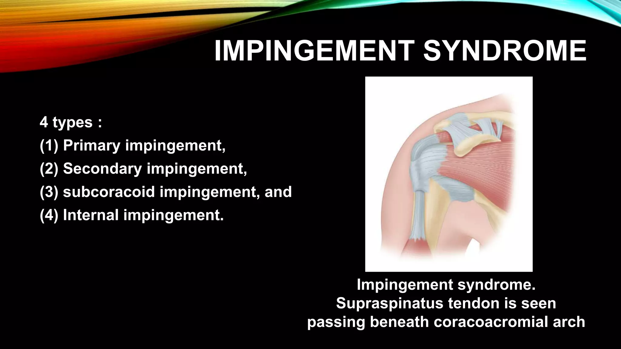Shoulder pathologies | PPTX
