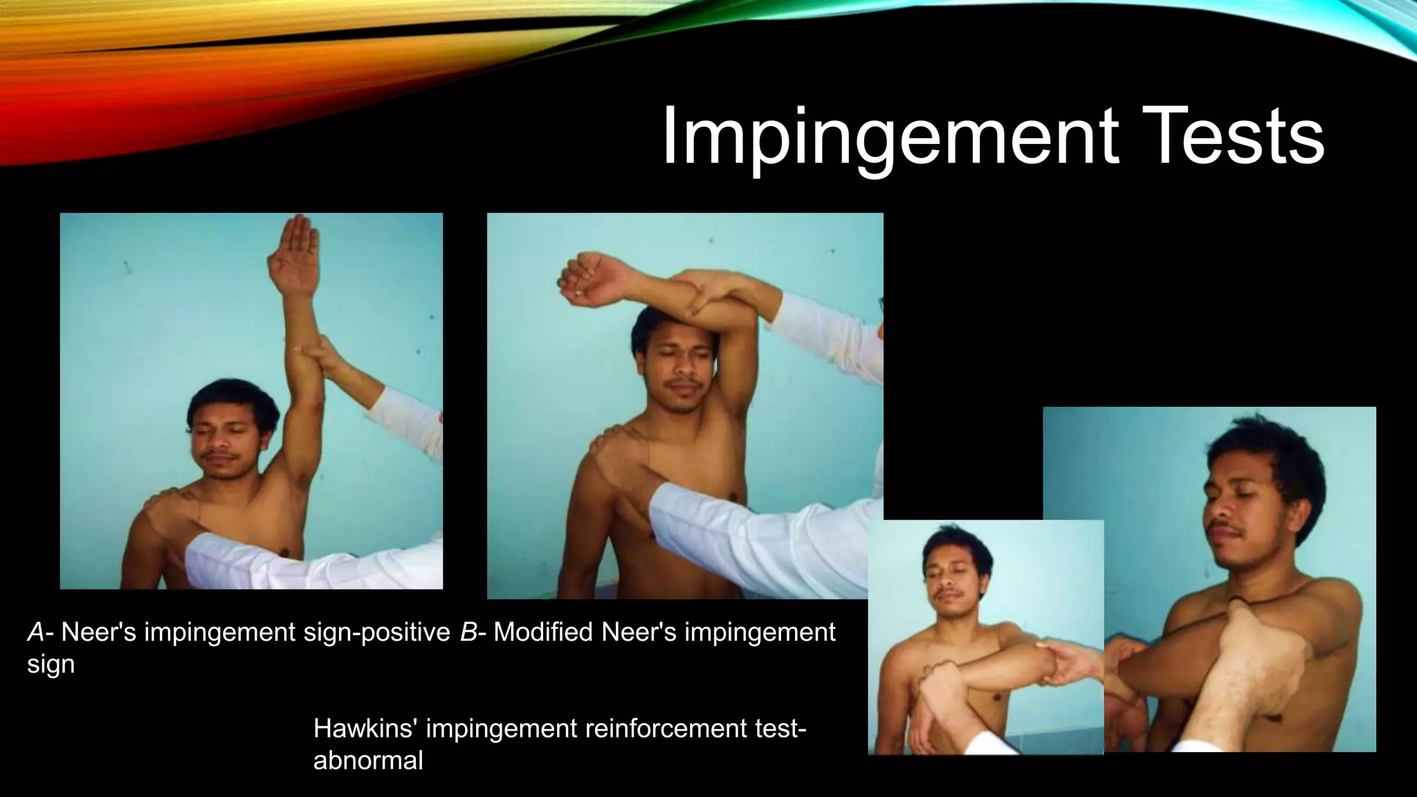 Shoulder pathologies | PPTX