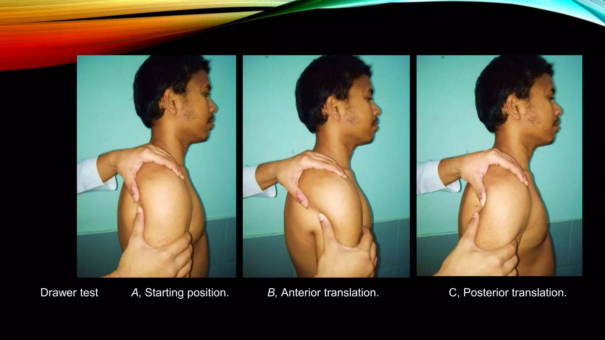 Shoulder pathologies | PPTX