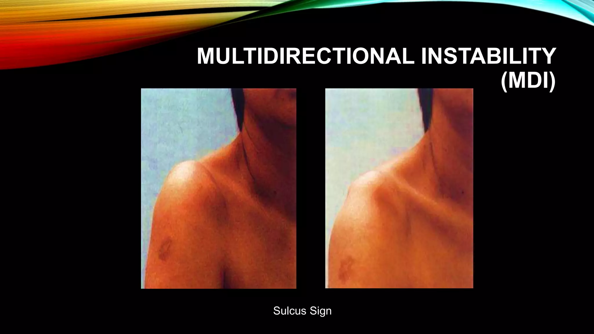 Shoulder pathologies | PPTX