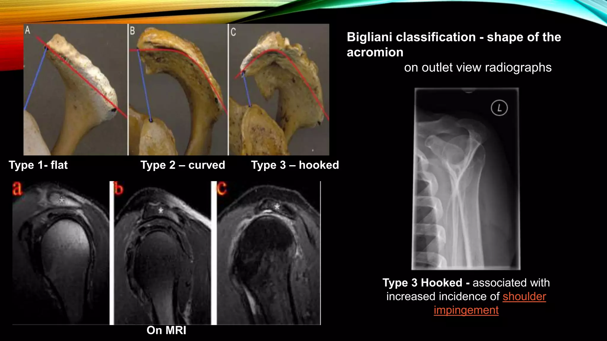 Shoulder pathologies | PPTX