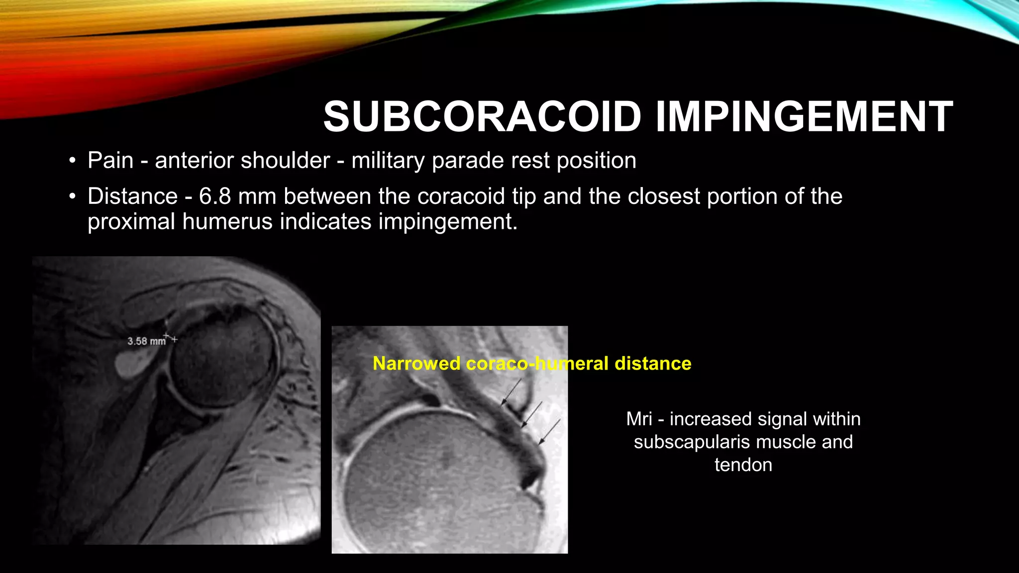Shoulder pathologies | PPTX