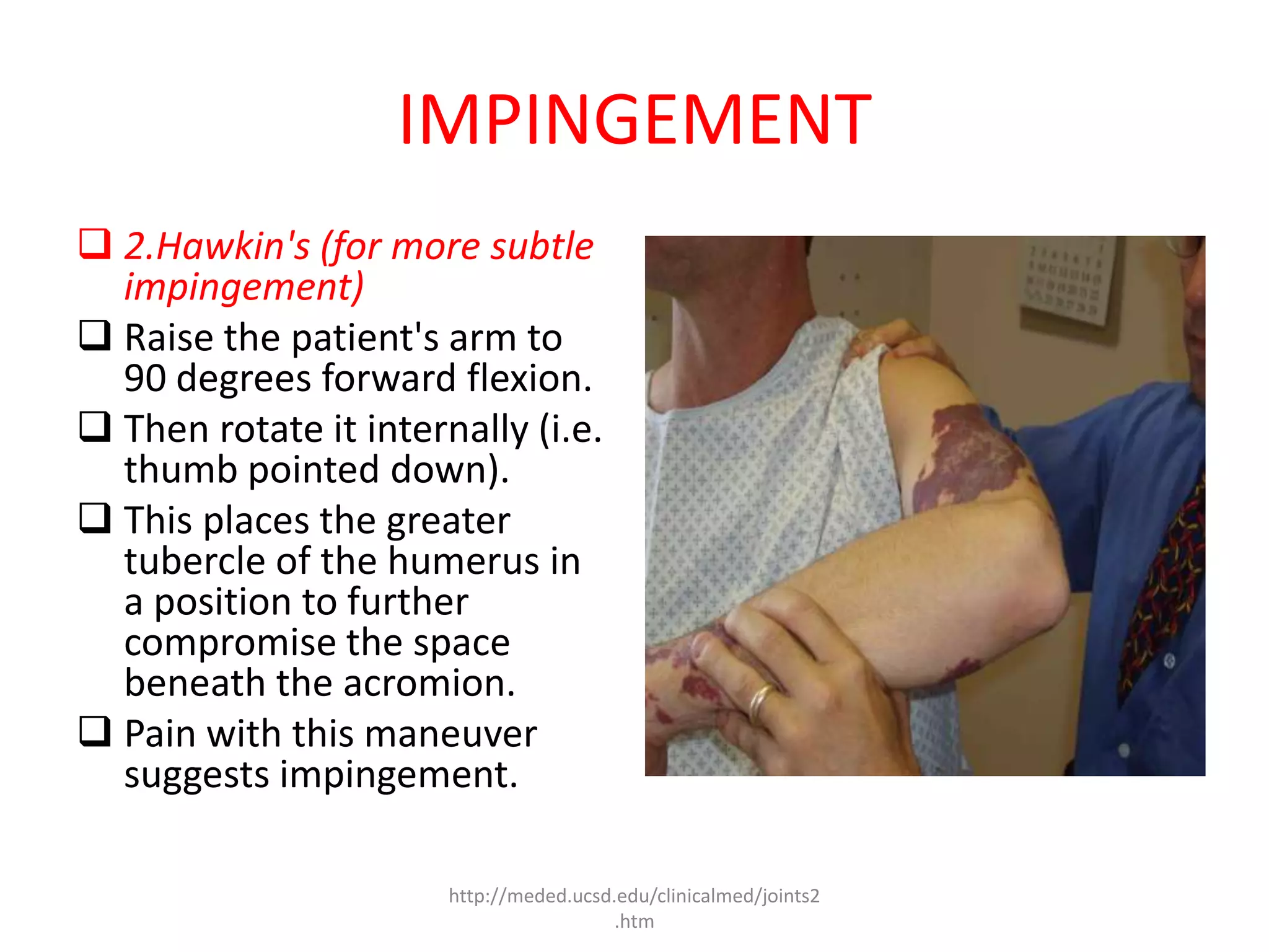 Shoulder pathomechanics | PPTX