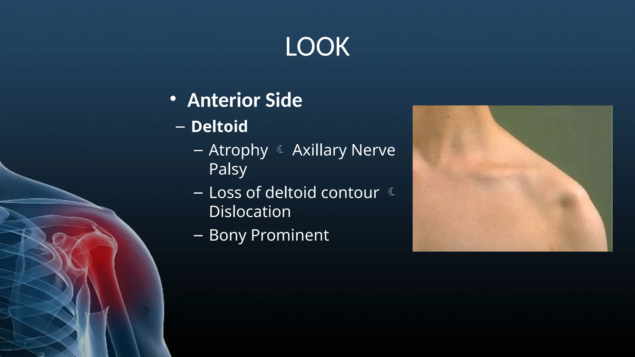 SHOULDER PHYSCICAL EXAMINATION & APPROACH.pptx