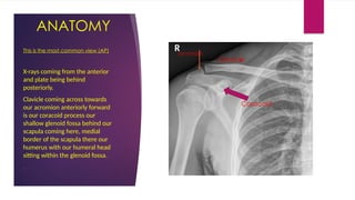 Shoulder Radiographic imaging EMERGENCY PAIN.pptx