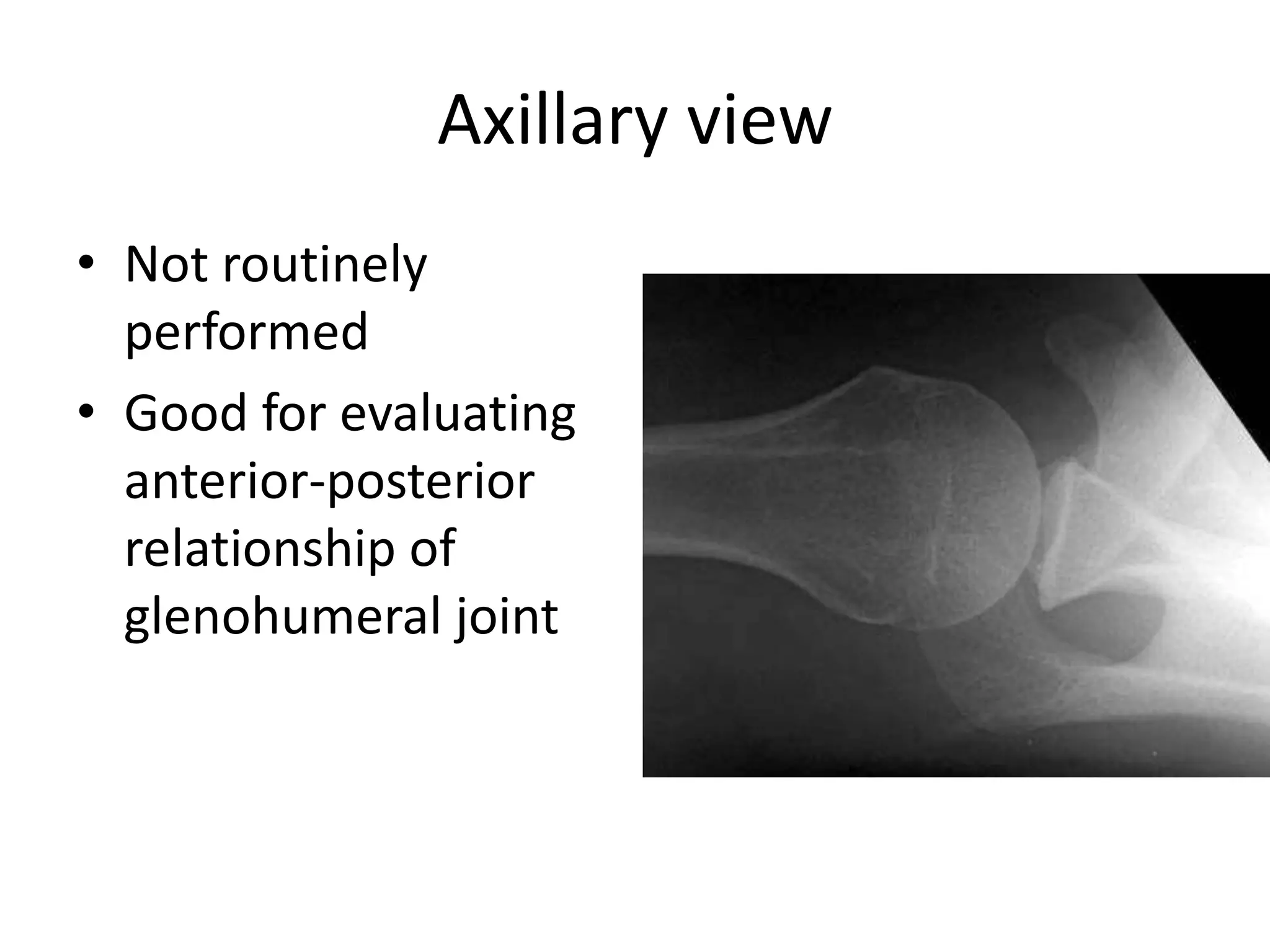 Shoulder radiography | PPTX