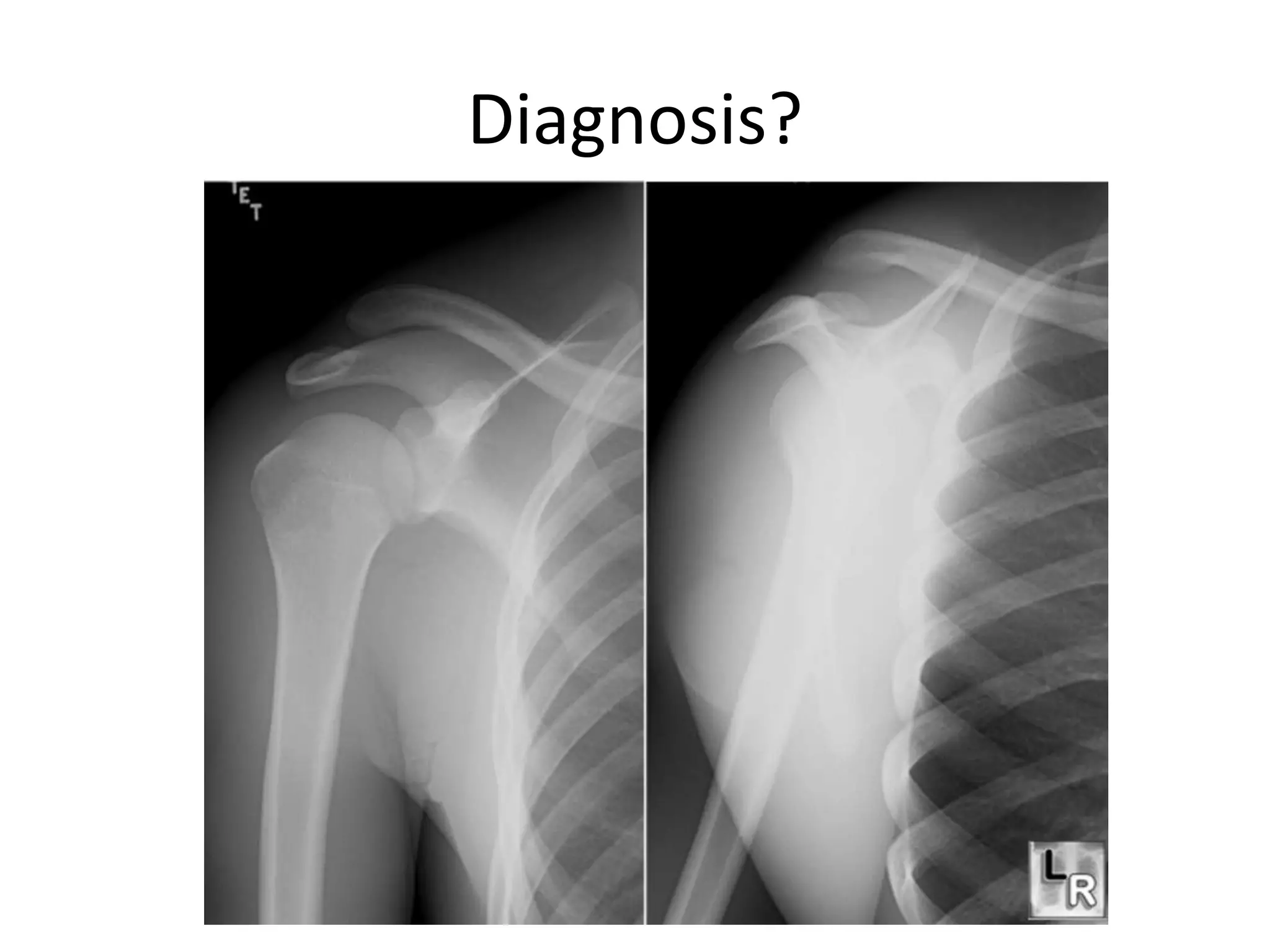 Shoulder radiography | PPTX