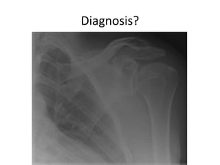 Shoulder radiography | PPTX