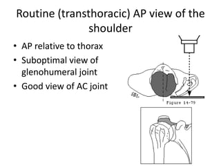 Shoulder radiography | PPTX