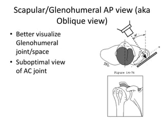 Shoulder radiography | PPTX