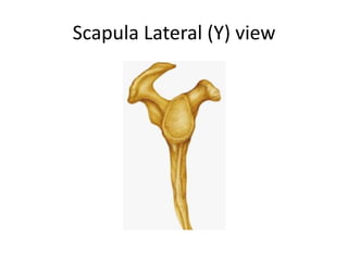 Right Scapula Lateral View