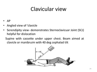 Shoulder radiologic anatomy | PPTX