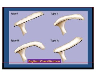 Shoulder radiologic anatomy | PPTX