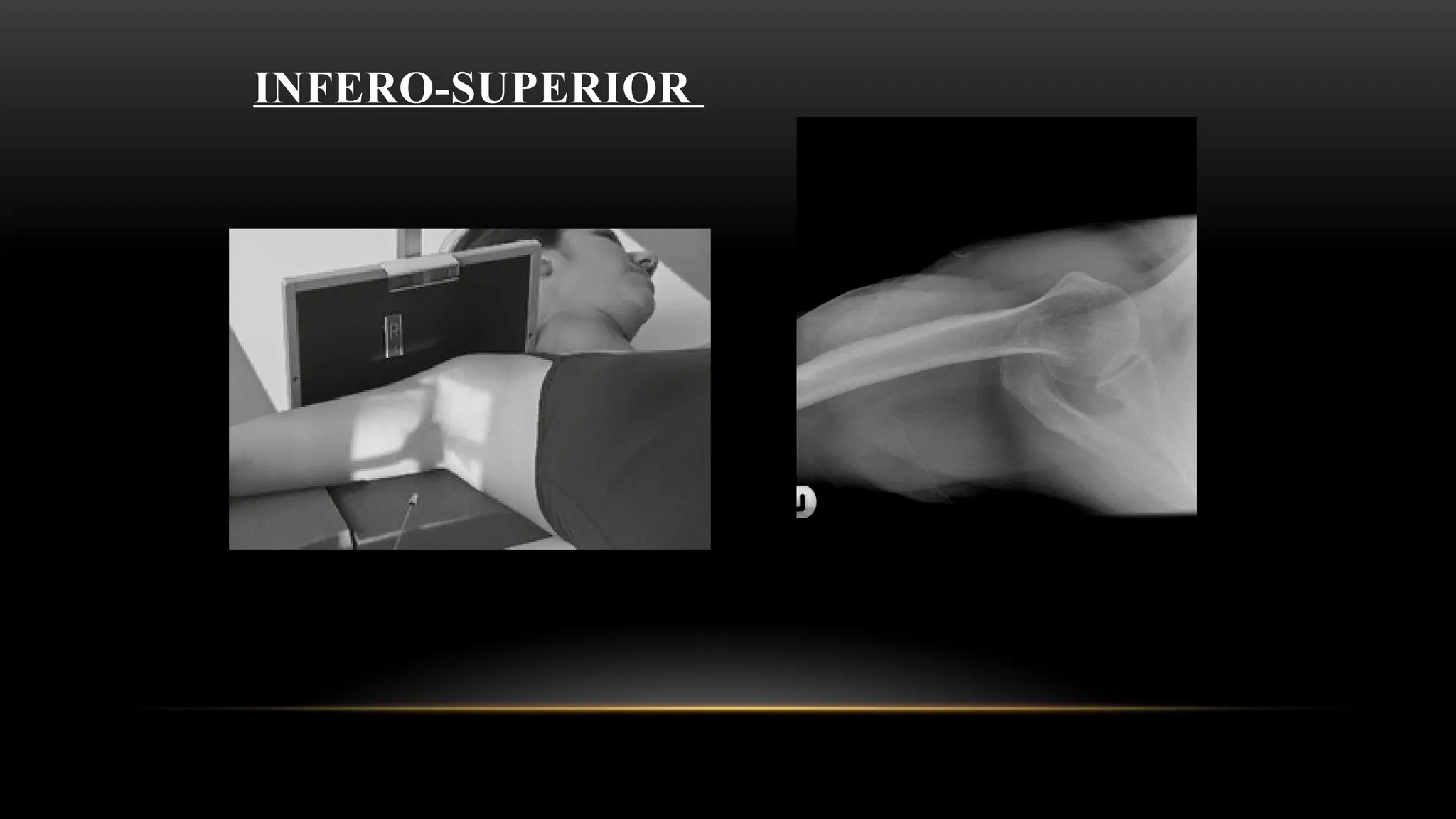 Shoulder RADIOGRAPHY.pptxShoulder RADIOGRAPHY.pptxShoulder RADIOGRAPHY.pptx