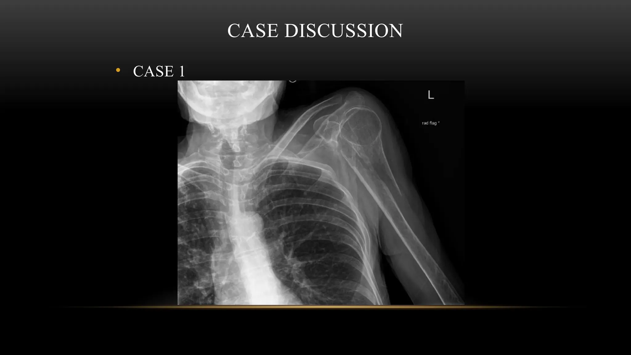 Shoulder RADIOGRAPHY.pptxShoulder RADIOGRAPHY.pptxShoulder RADIOGRAPHY.pptx