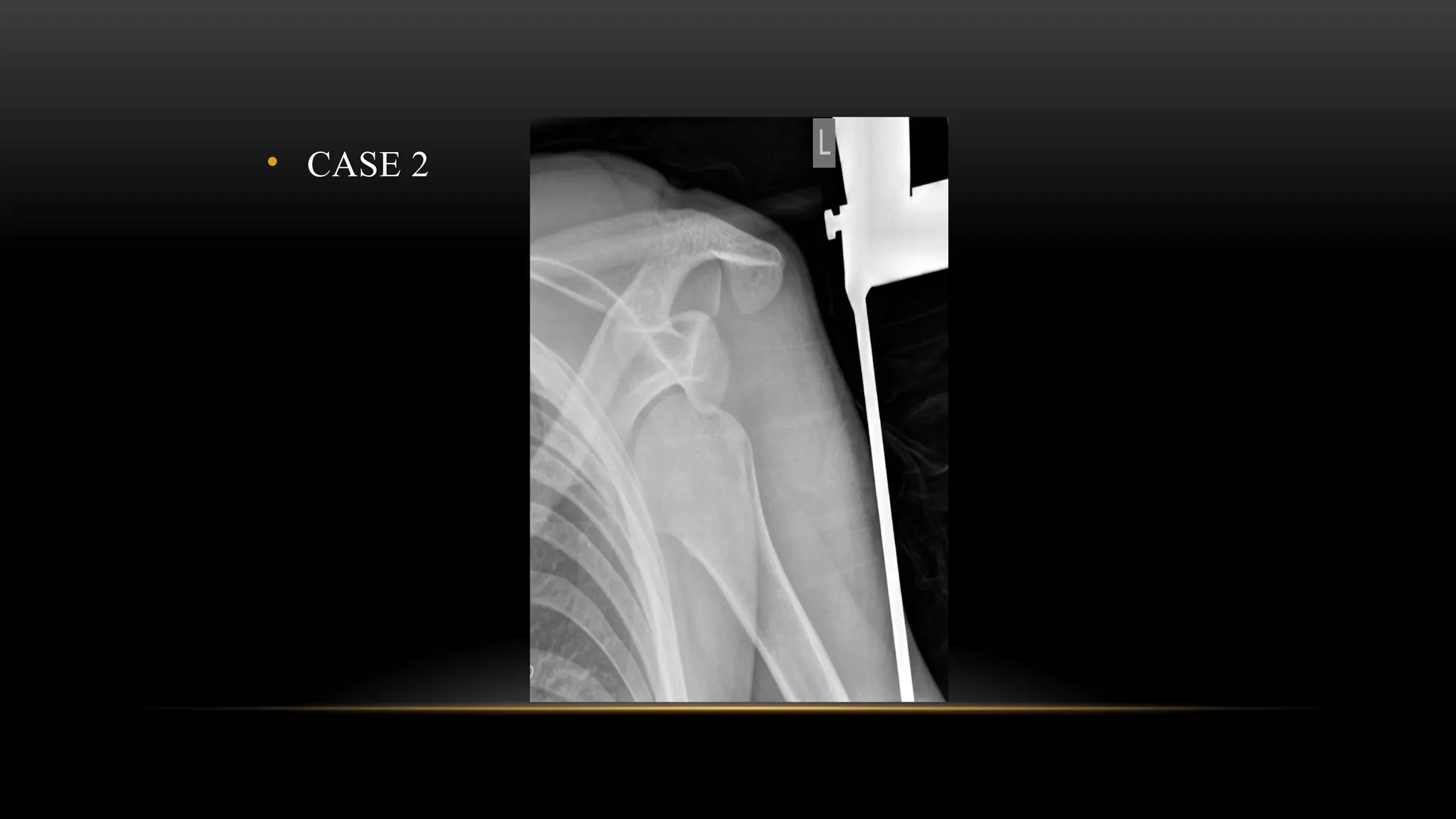 Shoulder RADIOGRAPHY.pptxShoulder RADIOGRAPHY.pptxShoulder RADIOGRAPHY.pptx