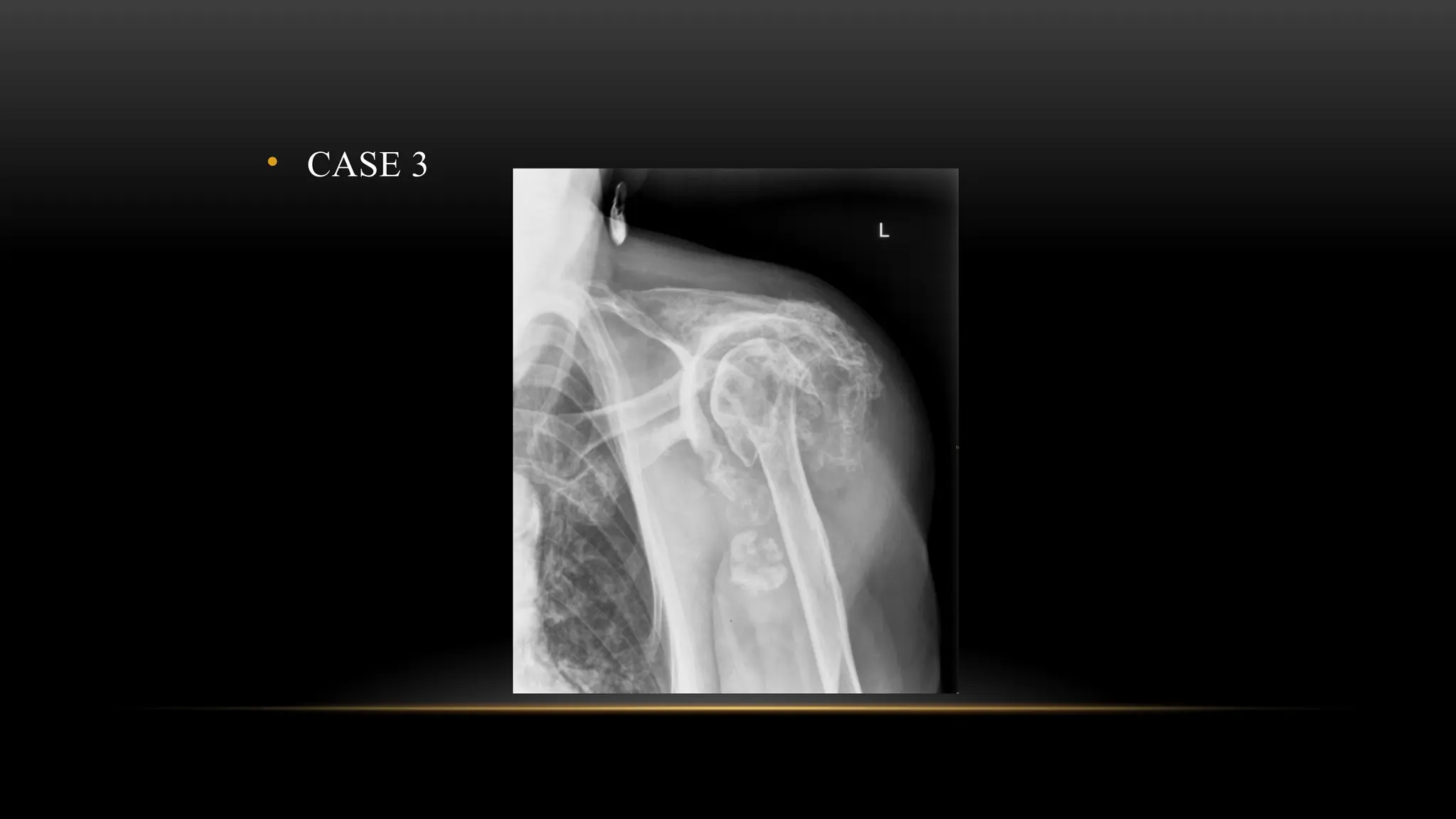 Shoulder RADIOGRAPHY.pptxShoulder RADIOGRAPHY.pptxShoulder RADIOGRAPHY.pptx