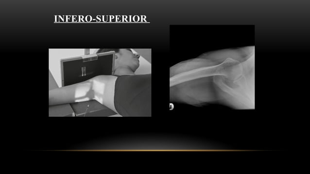 Shoulder RADIOGRAPHY.pptxShoulder RADIOGRAPHY.pptxShoulder RADIOGRAPHY.pptx