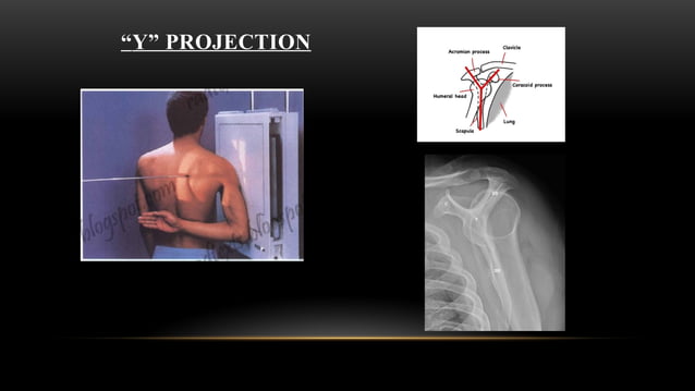 Shoulder RADIOGRAPHY.pptxShoulder RADIOGRAPHY.pptxShoulder RADIOGRAPHY.pptx