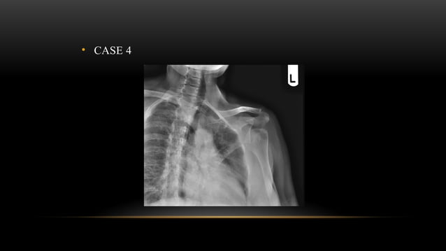Shoulder RADIOGRAPHY.pptxShoulder RADIOGRAPHY.pptxShoulder RADIOGRAPHY.pptx