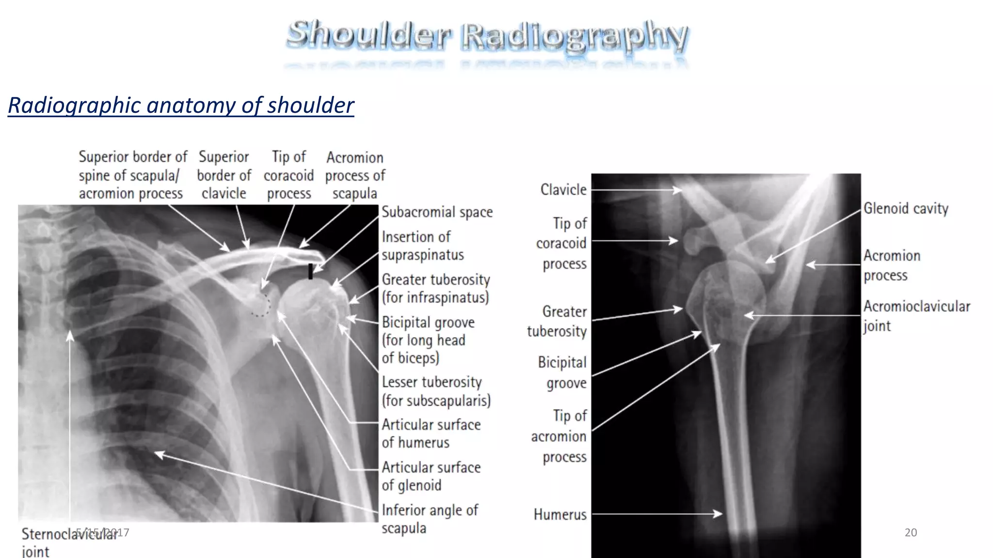 Shoulder radiography avinesh shrestha | PPTX