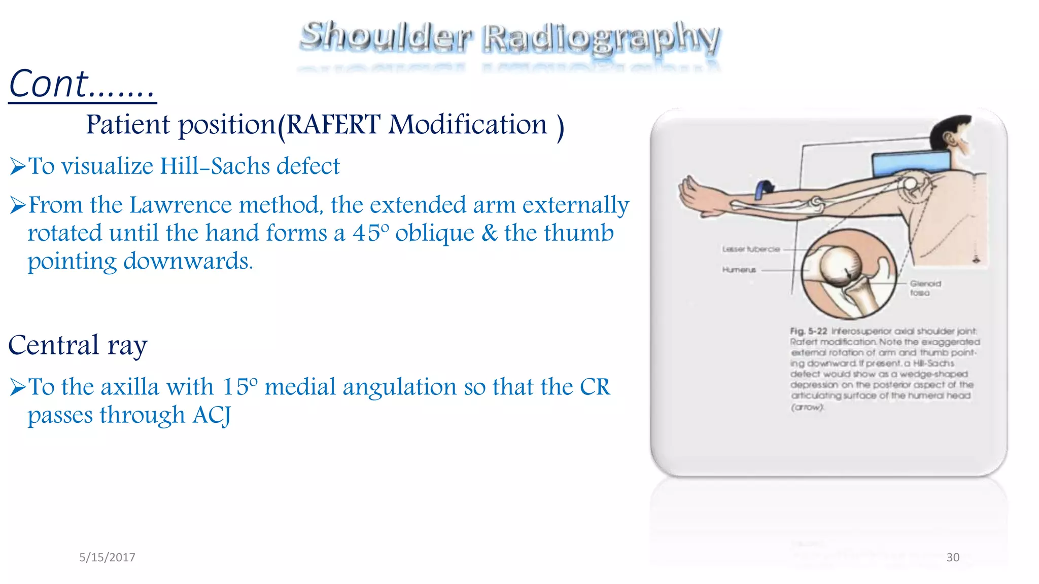 Shoulder radiography avinesh shrestha | PPTX