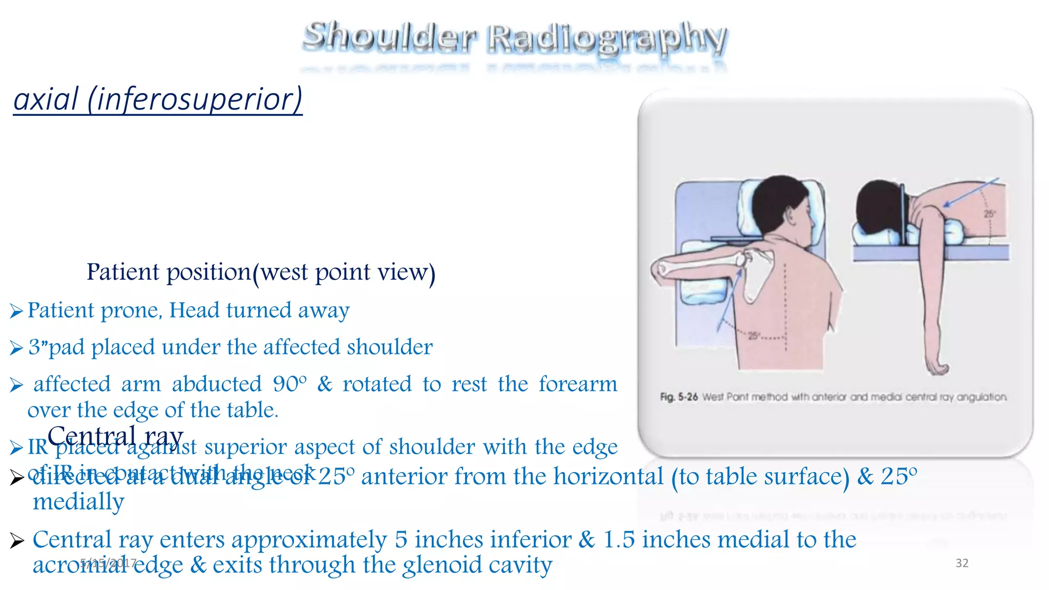 Shoulder radiography avinesh shrestha | PPTX