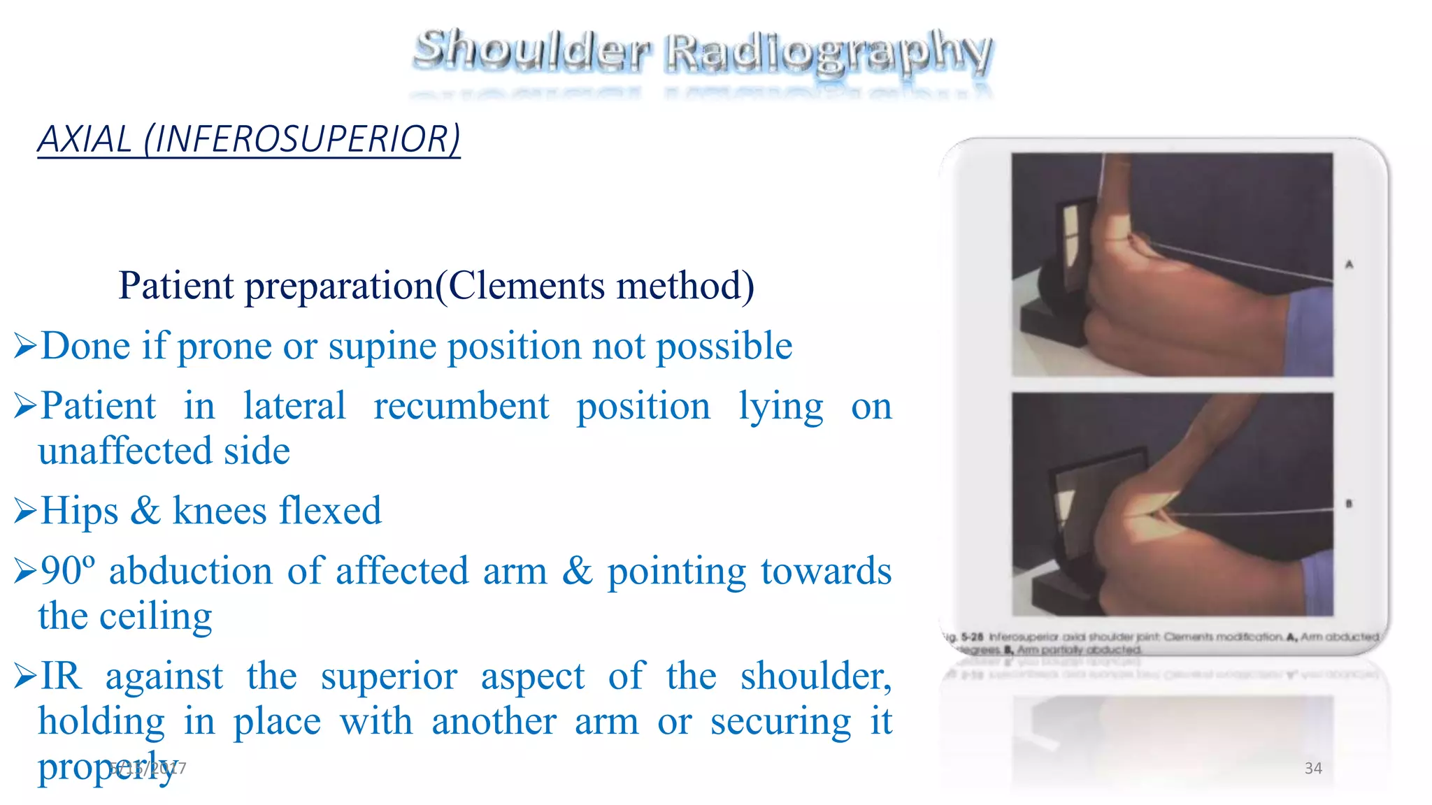 Shoulder radiography avinesh shrestha | PPTX