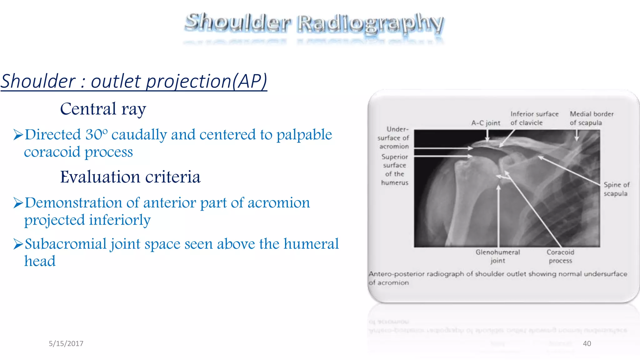 Shoulder radiography avinesh shrestha | PPTX