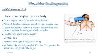 Shoulder radiography avinesh shrestha | PPT
