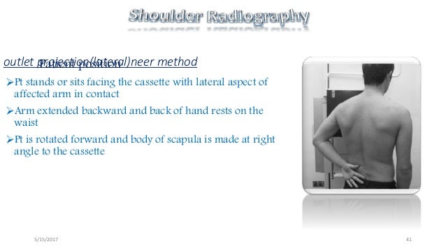 Outlet Projection View Shoulder | semashow.com